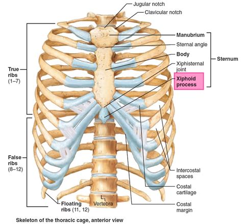 Xiphoid Process Protrusion