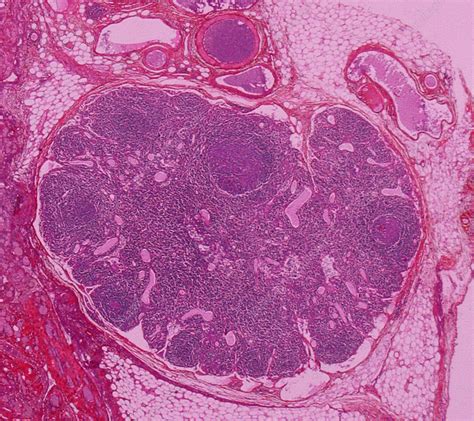 Normal Lymph Node Light Micrograph Stock Image C0443100 Science