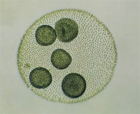 Microbio Lab Exam Flashcards Quizlet