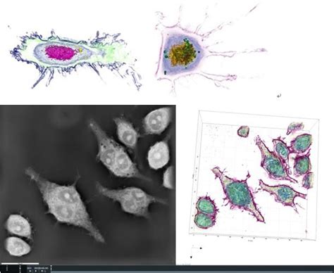 巨噬细胞显微镜图片 巨噬细胞吞噬手绘图 巨噬细胞图片 第2页 大山谷图库