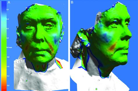 A Frontal And B Right Face Three Quarters Views Of 3d Colorimetric