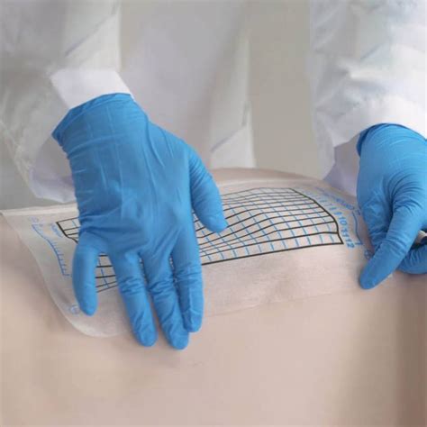 Disposable Ct Biopsy Fast Find Grid From Webb Manufacturing Eg6500
