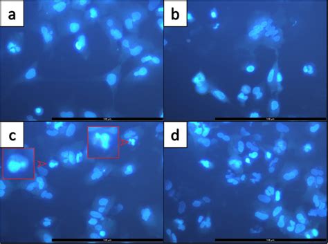 Cell Nuclear Staining With Hoechst 33258 20x Magnification 24 H A