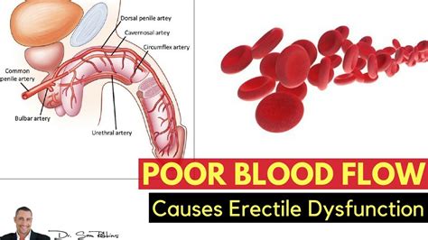 How Poor Blood Flow Causes Erectile Dysfunction How To Quickly Fix