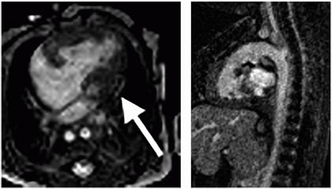 Pediatric Cardiac Radiology Obgyn Key