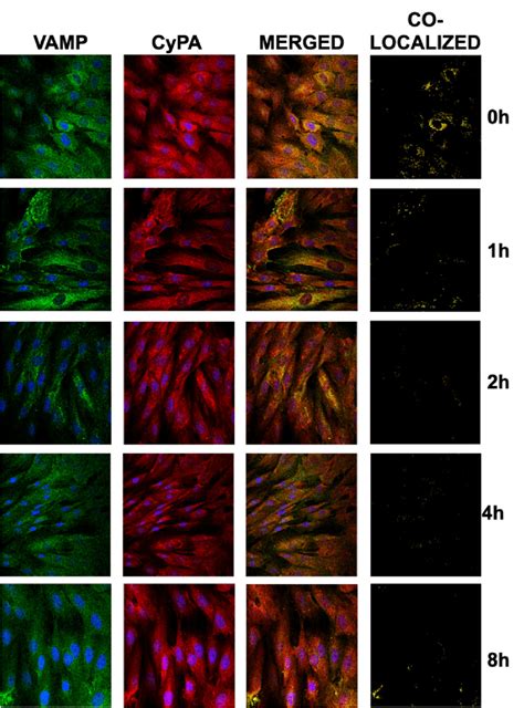Ivabradine Reduces The Secretion Of Cypa In Cardiac Cells H9c2 Cells