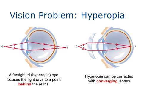 Lenses And The Human Eye
