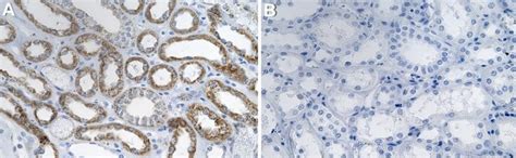Zrb2761 Anti Mitofusin 1 Antibody Recombinant Lyophilized