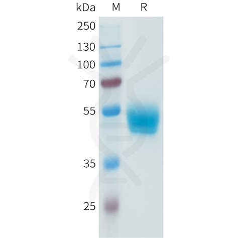 Human Pd L1128 238 Protein Hfc Tag 专注肿瘤免疫