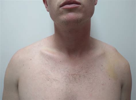 Racgp Ajgp Australian Journal Of General Practice