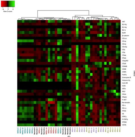 High Multiplex Analysis Of The Immune Microenvironment In Bone Marrow Trephine Samples Using