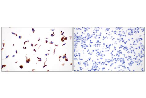 Col4a1 E5m6r Rabbit Mab Ihc Formulated Cell Signaling Technology