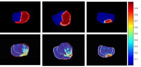 Results Of Prostate Cancer Detection Produced By Wang Et Al [46] Using Download Scientific
