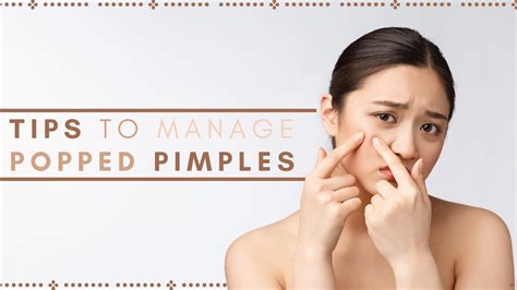 Popped That Pimple Tips To Take Care Of It And The Surrounding Skin