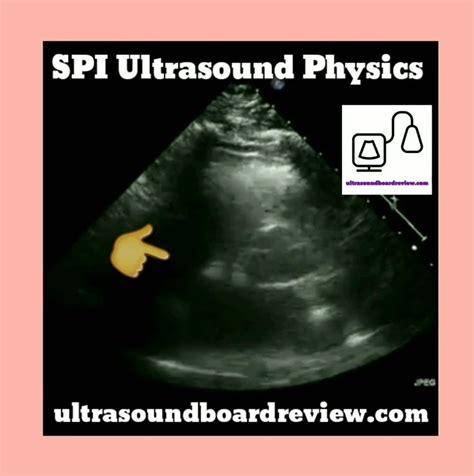 Grating Lobe Artifact