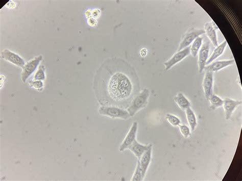 Have You Ever Observed This Contamination In Hela Cell Is It Fungal