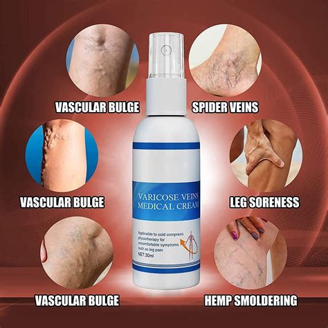 Varicose Treatment Spray Vein Fix Varicose Vein Spray Varicose Veins