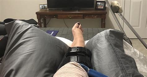 I Just Had My 12th Knee Procedure And My Fiancé Is Taking Care Of Me He Is Trying To Be A Good