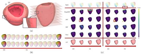 D Myocardium Reconstruction With Decoupled Motion And Shape Model