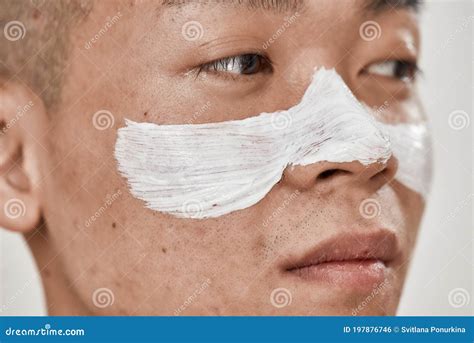 Close Up Of Face Of Young Asian Man With Problematic Skin And
