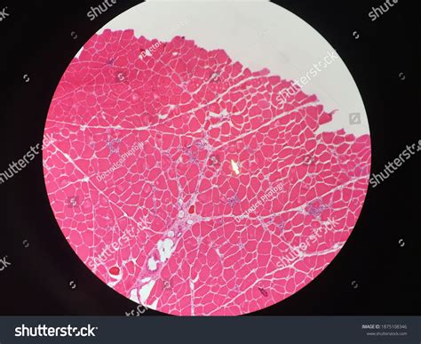 Skeletal Muscle Fiber Microscope