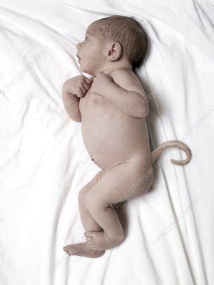 Si un bébé naît avec une queue serait il considéré comme humain Quora
