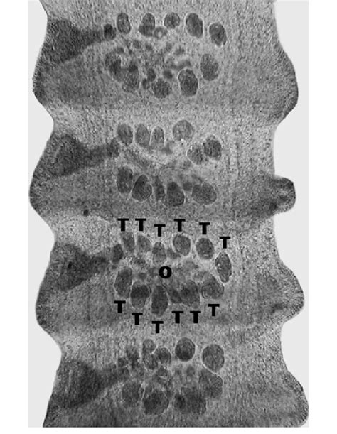 Section Of Mature Strobila Of Tetrabothrius Wrighti Found In The