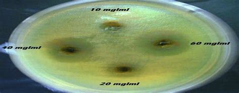 Sensitivity Staph Aureus Of To Datura Innoxia Extract Mg Ml Download High Resolution