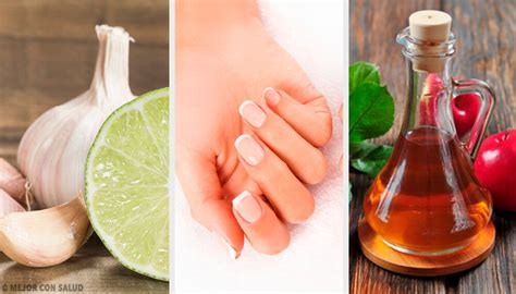 5 remedios naturales para hacer crecer las uñas Mejor con Salud