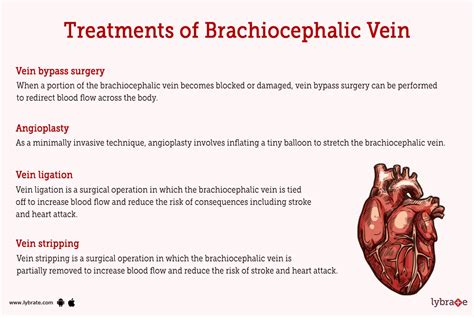 Brachiocephalic Vein