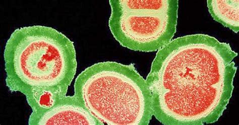 Pensioner Dies After C Diff Outbreak At Perth Royal Infirmary Daily