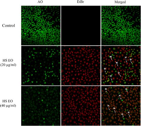 Apoptotic Morphology Detection By Acridine Orange Ethidium Bromide Download Scientific Diagram