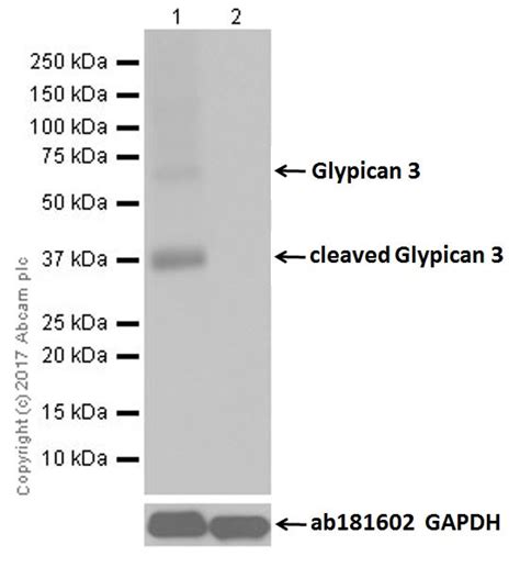 Anti Glypican 3 Antibody Epr20569 Ab207080 Abcam