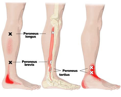 Fibularis Longus Tendon