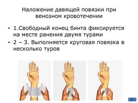 Кровотечения Виды кровотечений Оказание первой помощи при