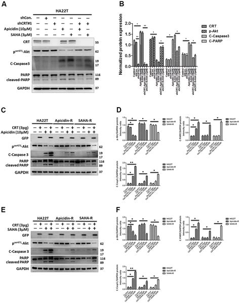 Calreticulin Nuclear Translocalization Alleviates Camcamkiicreb