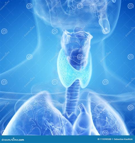 Hashimotos Thyroiditis Vector Illustration Labeled Medical Diagram