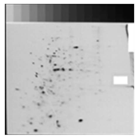 2d Gel Electrophoresis Image Of The First Sample Of Patient Human Download Scientific Diagram