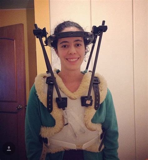 Halo Brace Halo Brace Braces Girls Braces