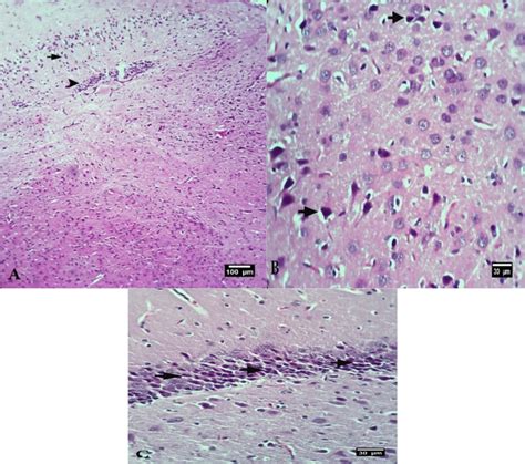 Histopathology Of The Cerebrum In The Exposure2 Group A Cerebral