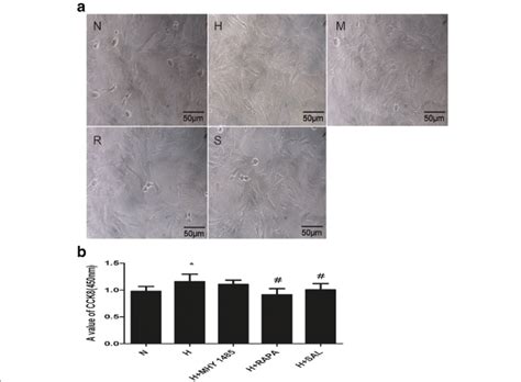 Autophagy Is Involved In Hypoxia Induced Pasmc Proliferation A Cell Download Scientific