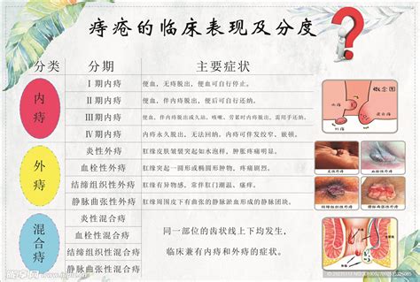 痔疮的临床表现设计图广告设计广告设计设计图库昵图网