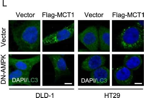 Lc3b Antibody Bsa Free Nb100 2220 By Novus Part Of Bio Techne