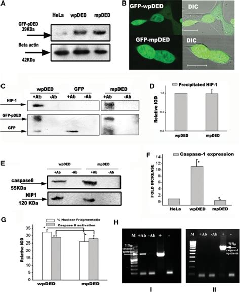 Expressions Of Wild Type And Mutated Gfp Pded Hippi Their Interactions