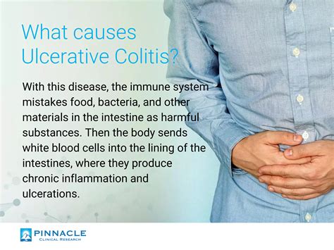 Understanding Ulcerative Colitis Pdf