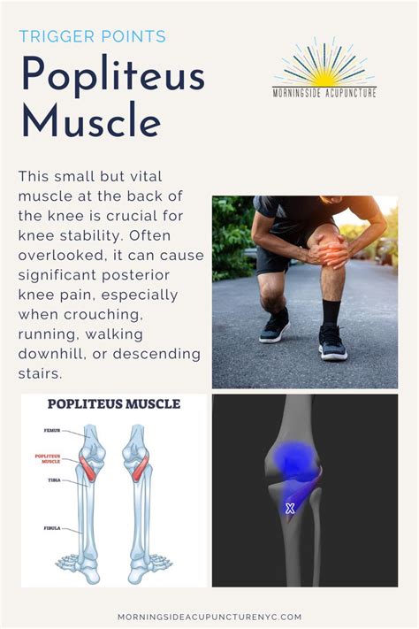 Popliteus Muscle Trigger Points Posterior Knee Pain Muscle Pain