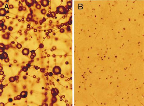 2 Effect Of Seed Exudates Cultured With Trichoderma Virens Preparations Download Scientific