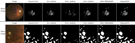 The Segmentation Results Of Our Method And Compared Methods Download