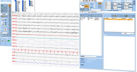 Somnipro Psg Deymed Diagnostic