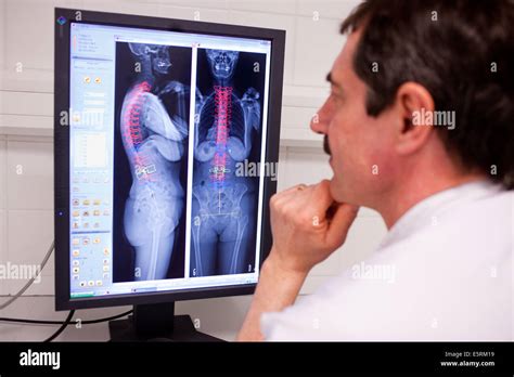 Eos Biplanar X Ray Scanner This 2d And 3d Digital X Ray Imaging